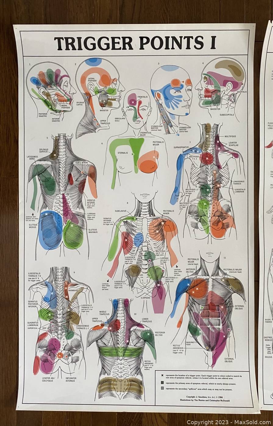 Vintage Laminated Trigger Points I & II Educational Posters | Maxsold